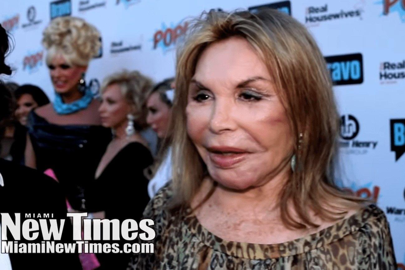 Elsa Patton received criticism from fans due to plastic surgery! - Eazeax